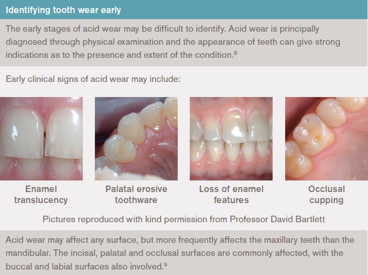 Tooth Wear and Dentine Hypersensitivity