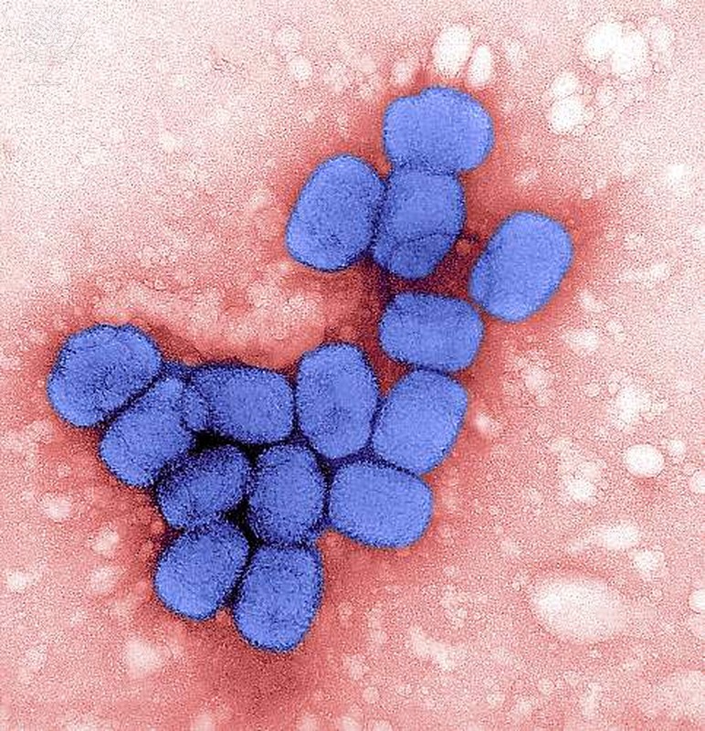 Smallpox smallpox