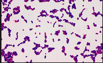 Streptococcus
