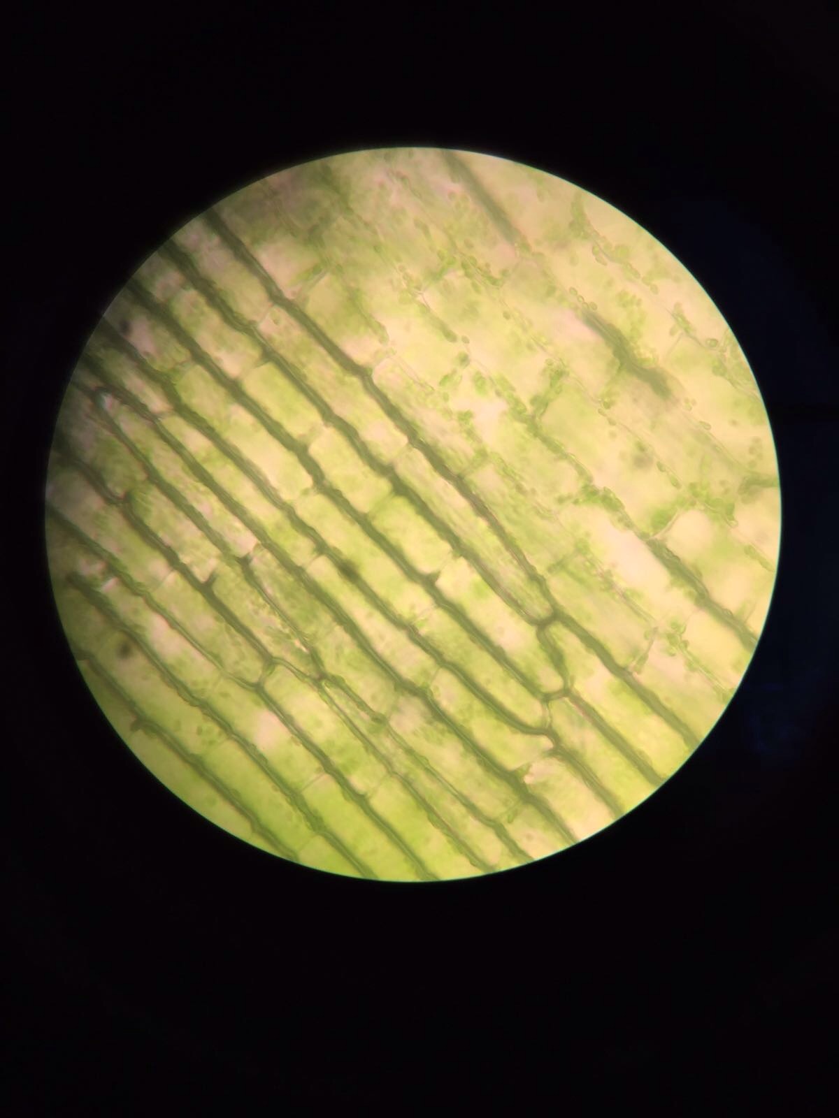 Cellule vegetali e Plasmolisi