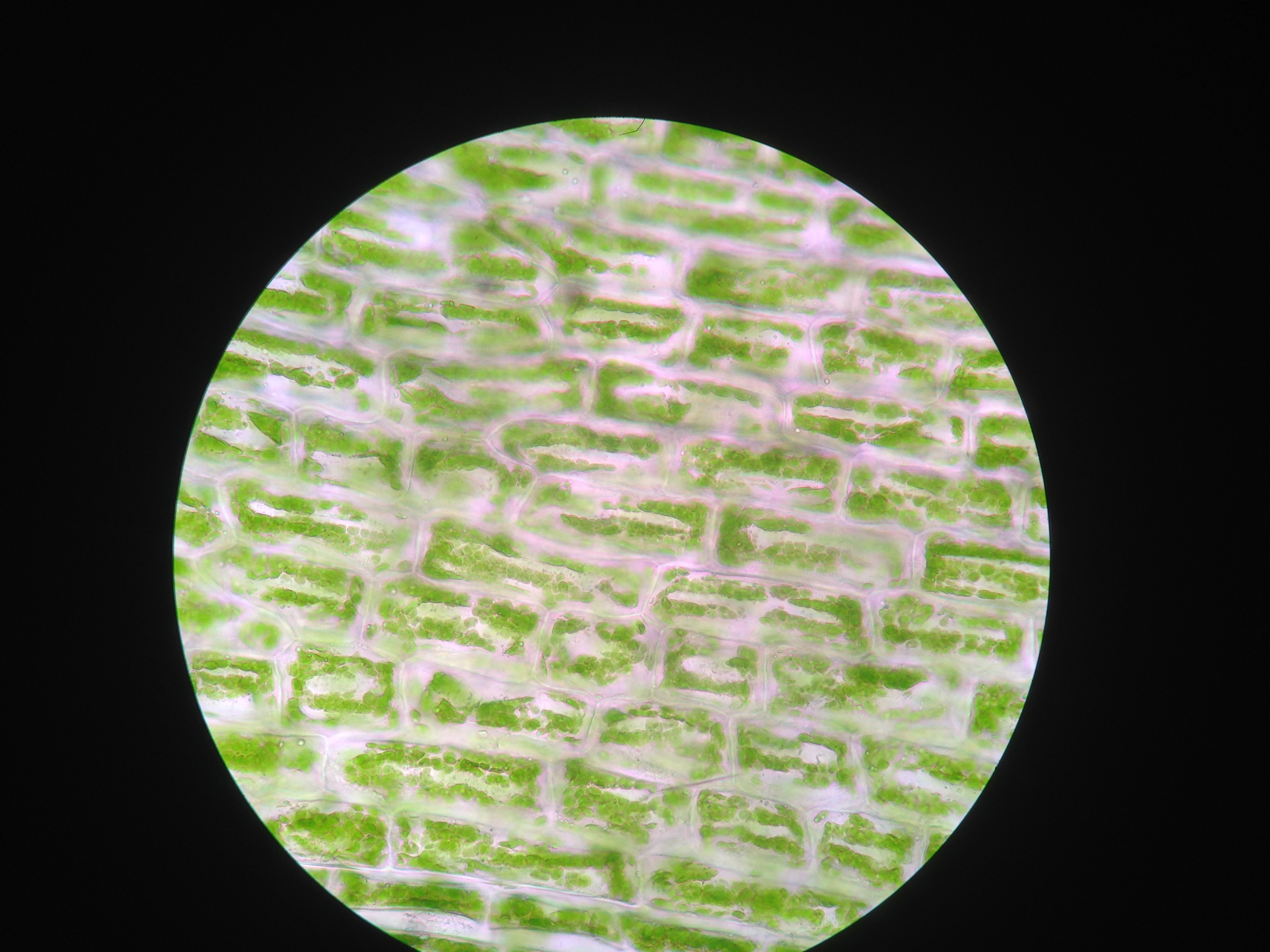 Cellule vegetali e Plasmolisi