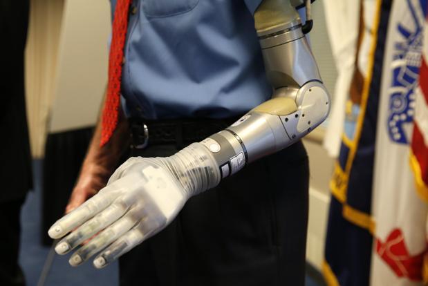 What are Prosthetic limbs?
