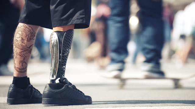 What are Prosthetic limbs?