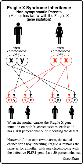 Fragile X Syndrome