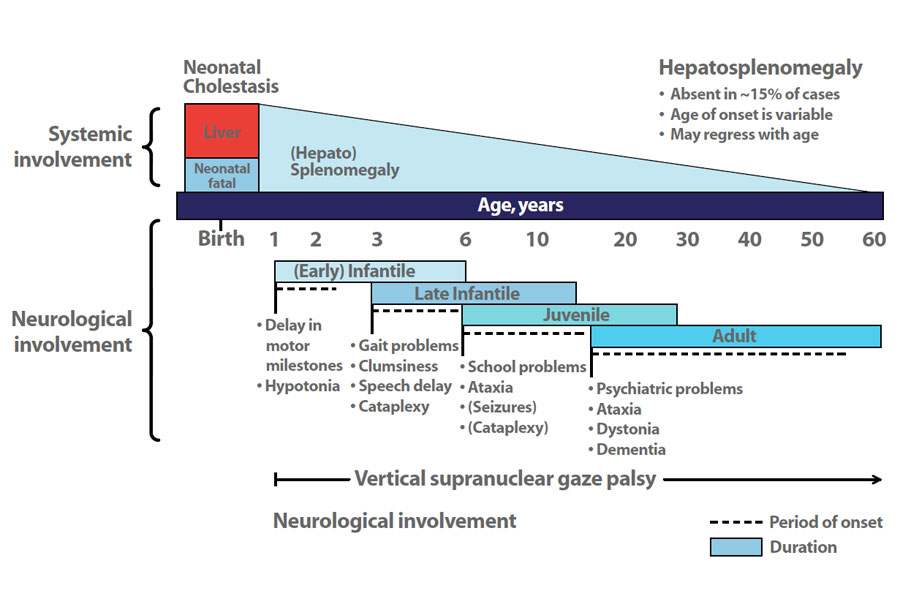 Niemann-pick disease