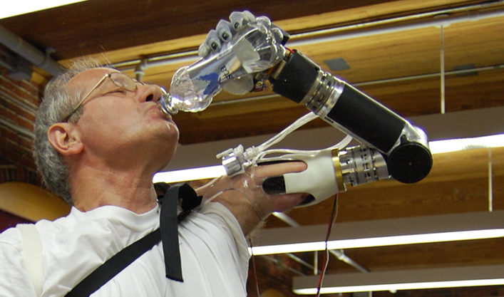 Robotic Prosthetic Arm