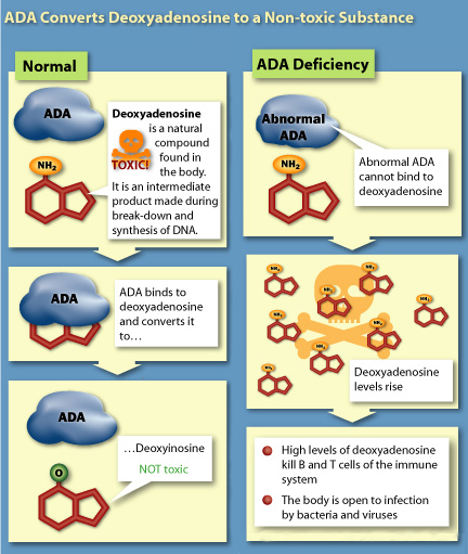 Adenosine Deaminase (ADA)