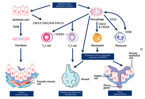 Chronic Obstructive Pulmonary Disease