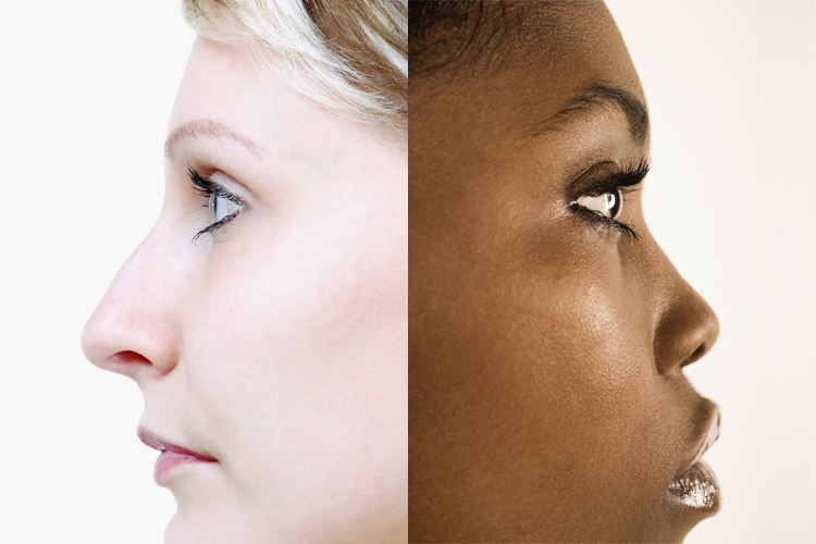 They're different than me, and?