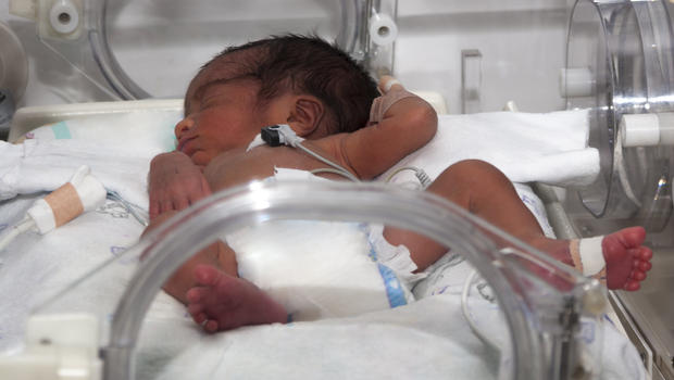 Low Birth Weight