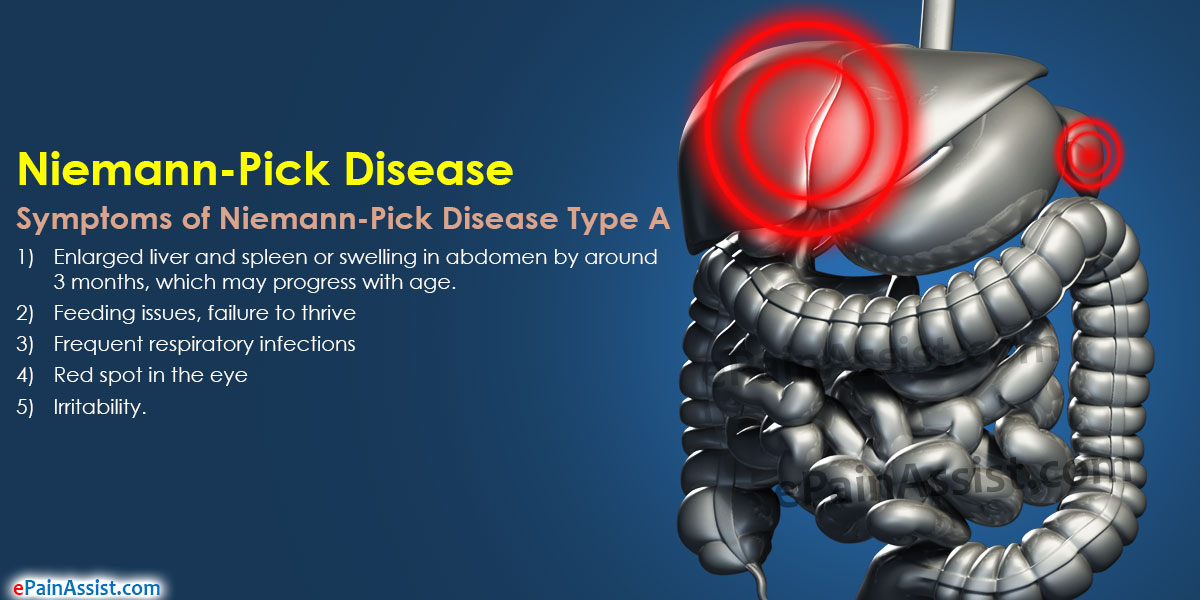 Niemann- Pick Disease Type A