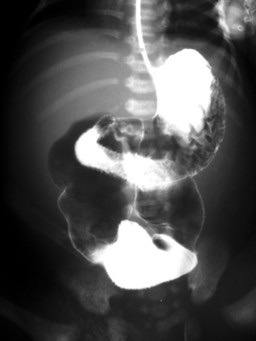X-Rays